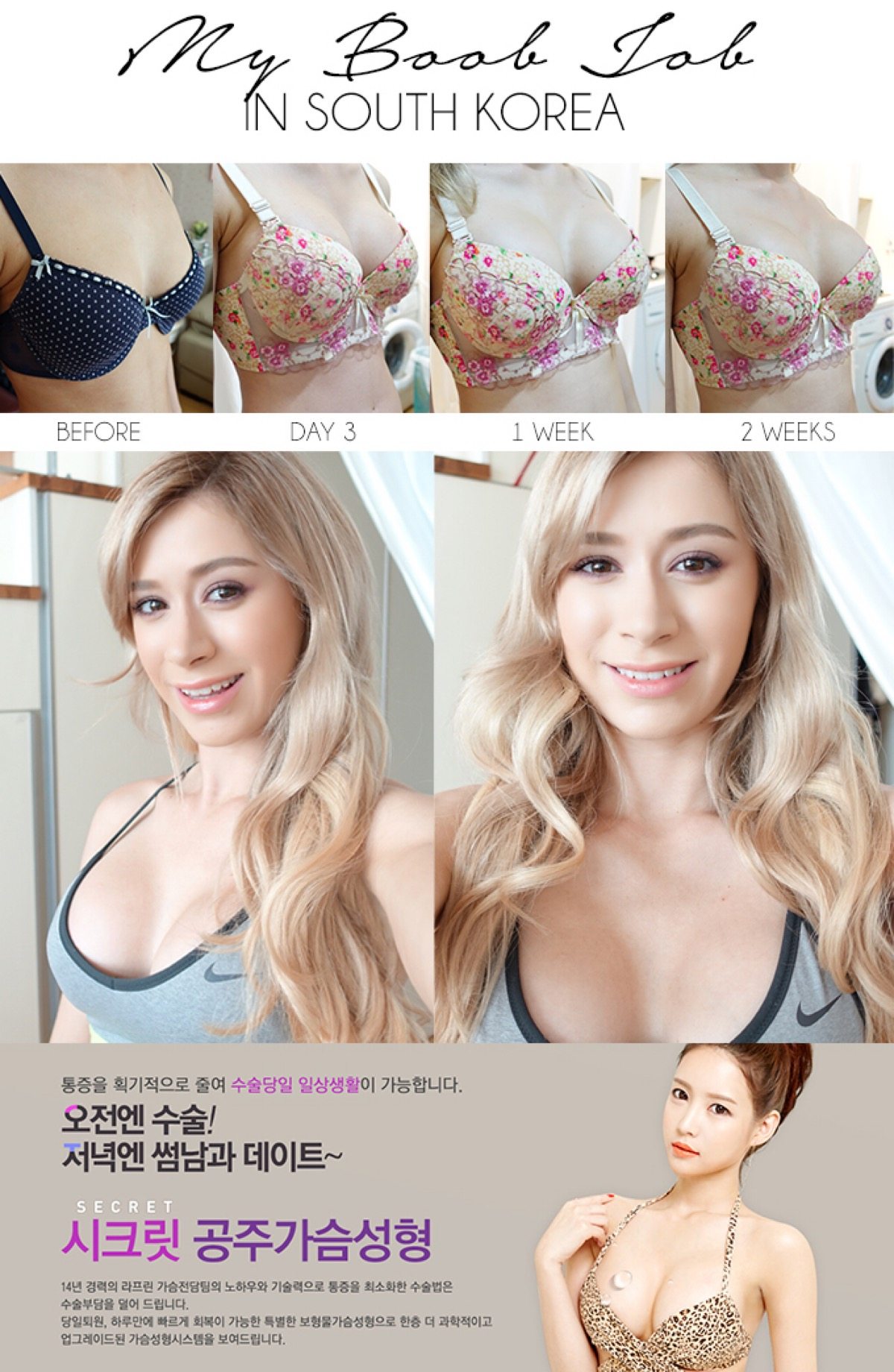 Foreigners Are Charged More For Plastic Surgery In Korea Than Koreans ... Foreigners Are Charged More For Plastic Surgery In Korea Than Koreans ...